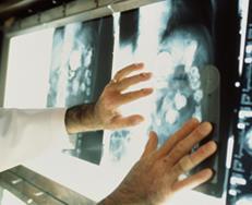 On This Day - Feb 07 : The first x-ray was taken | Resource | RSC Education