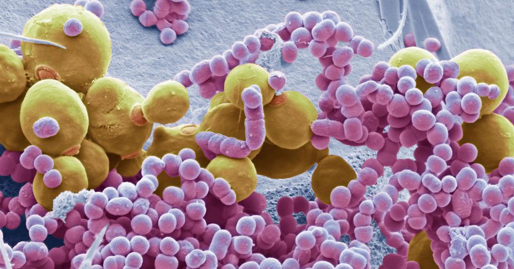 Why fermented foods are good for your gut – and your teaching | Feature ...