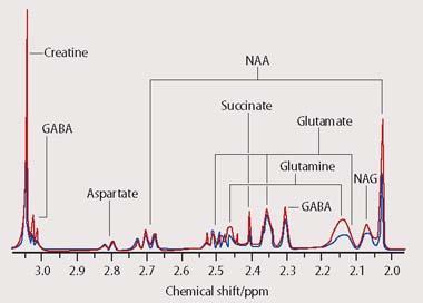 The Power of NMR: The Beginnings | Feature | RSC Education