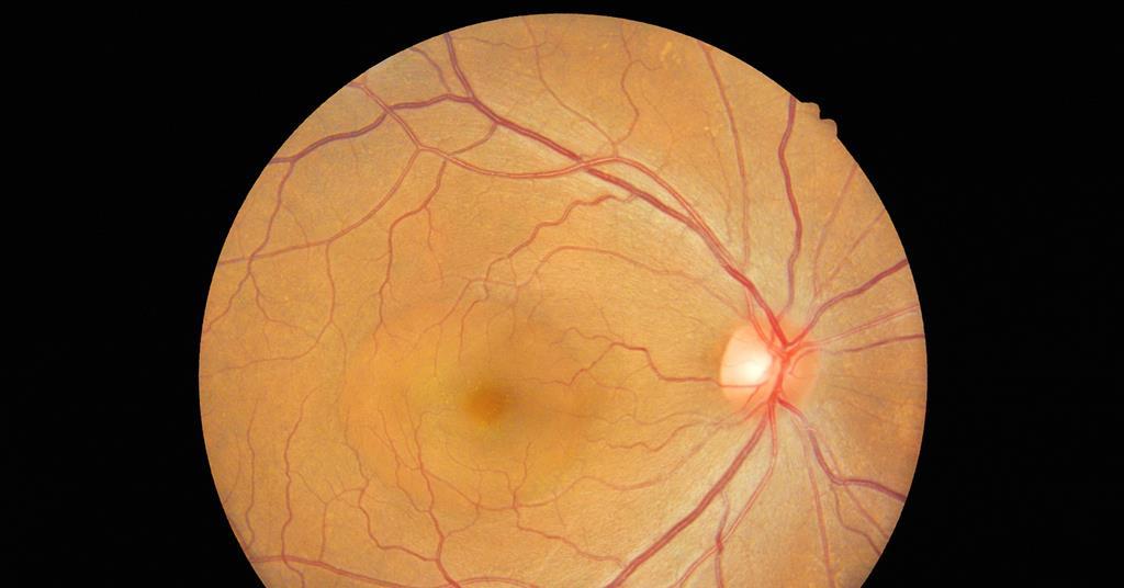 Synthetic retina is looking good | News | RSC Education