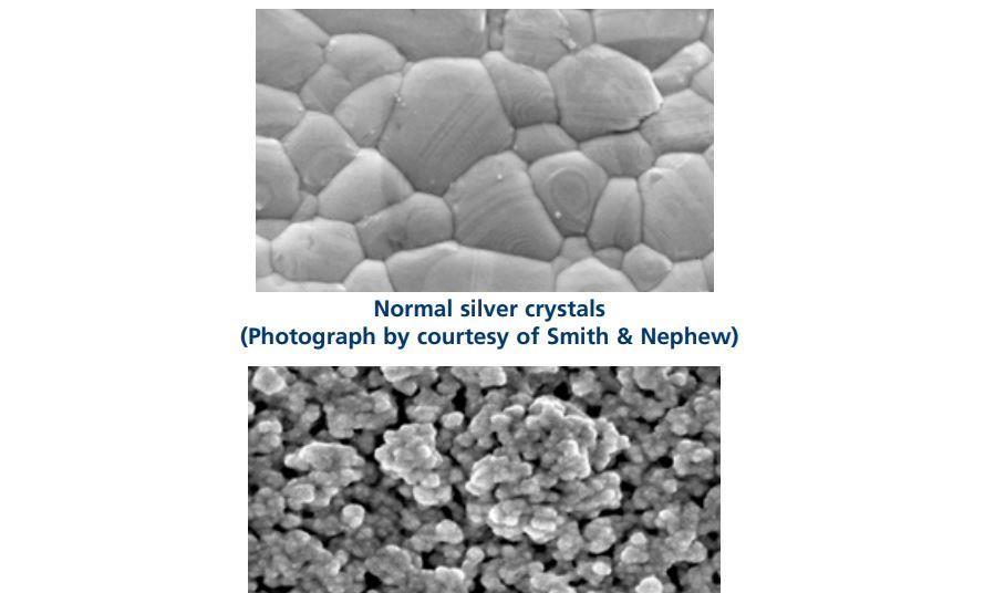 Nanosilver in medicine | Resource | RSC Education