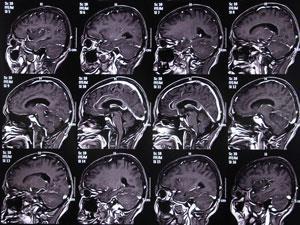 Moving the goalposts for MRI | News | RSC Education