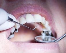 Chemistry of dentistry | Class experiment | RSC Education