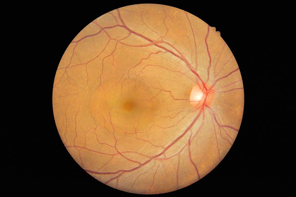 Synthetic retina is looking good | News | RSC Education