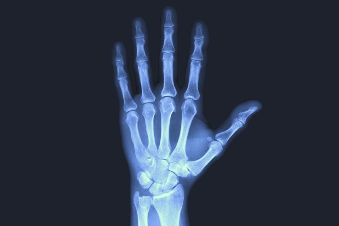 Bendy bones | Resource | RSC Education